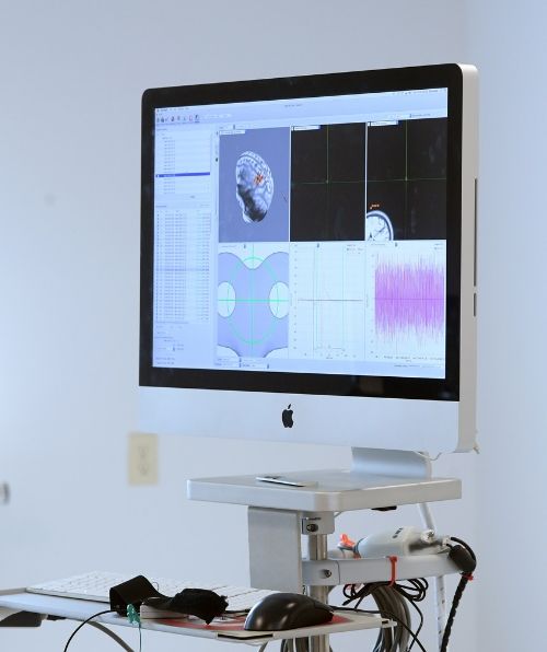 Official site of the Laboratory for Brain Recovery and Function ...